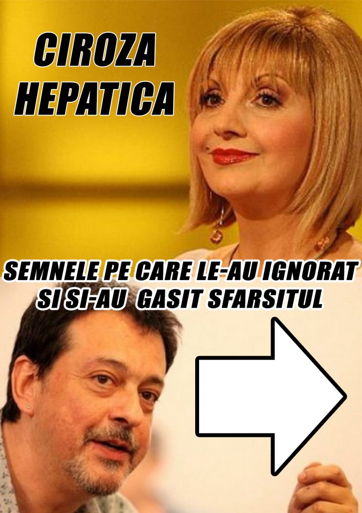 Ciroza hepatică, simptome pe care nimeni nu le baga in seama. Ileana ...