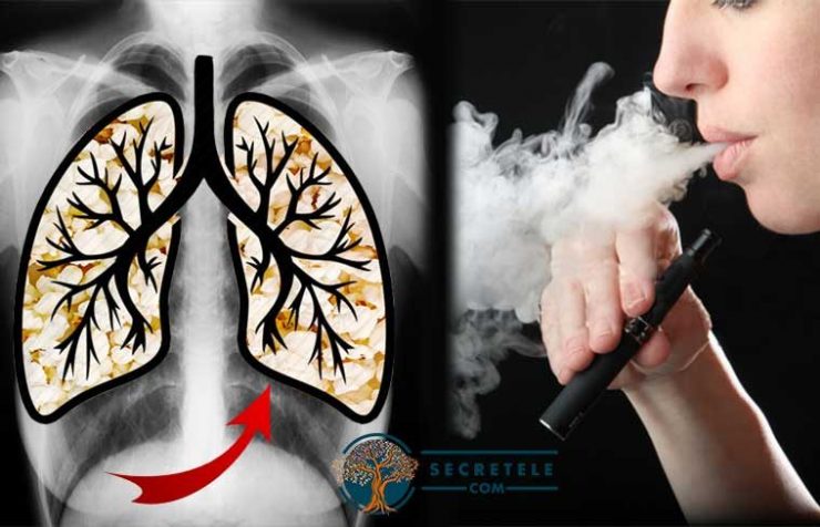 Țigările electronice duc la apariția unei boli incurabile, numită ...
